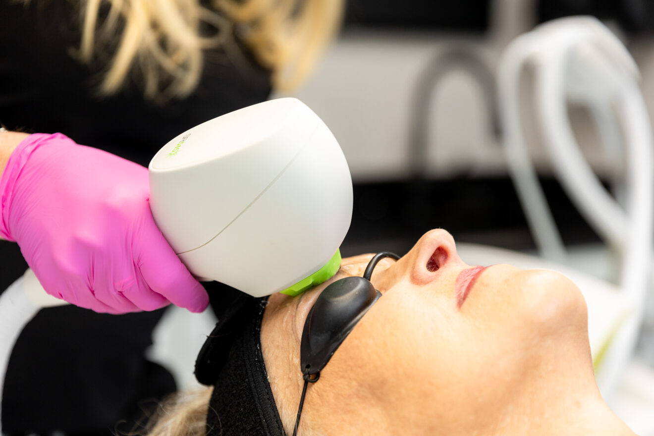 IPL Photofacials - The Laser Room Med Spa